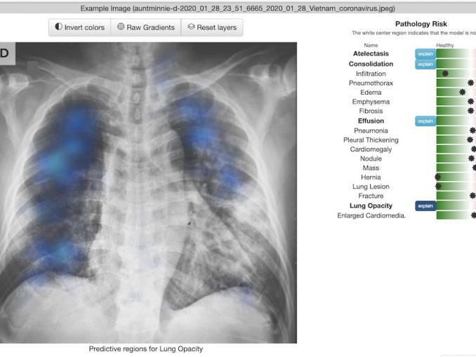 Visualizing CNN architectures side by side with mxnet - Joseph Paul ... Visualizing CNN architectures side by side with mxnet - Joseph Paul ...