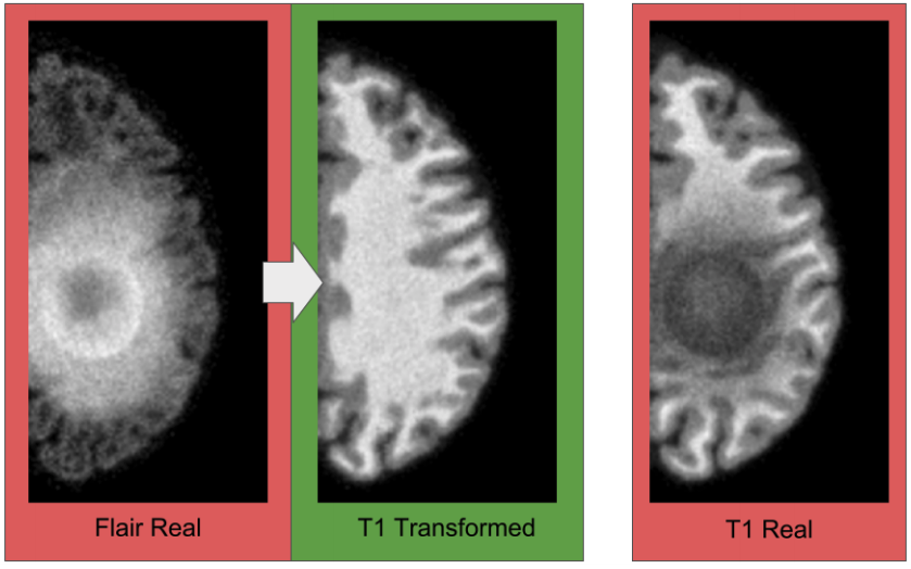 Feature Hallucination in Medical Image Translation - Joseph Paul Cohen PhD
